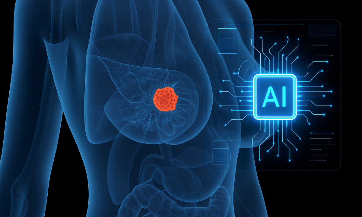 Inteligencia artificial que detecta cáncer de mama: el avance que ...